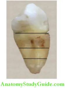 Surfaces of the Teeth - An Overview of Dental Anatomy - Anatomy Study Guide