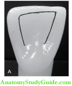Surfaces of the Teeth - An Overview of Dental Anatomy - Anatomy Study Guide