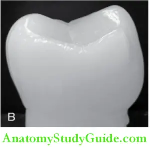 Surfaces of the Teeth - An Overview of Dental Anatomy - Anatomy Study Guide