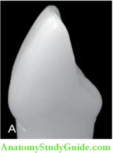 Surfaces of the Teeth - An Overview of Dental Anatomy - Anatomy Study Guide