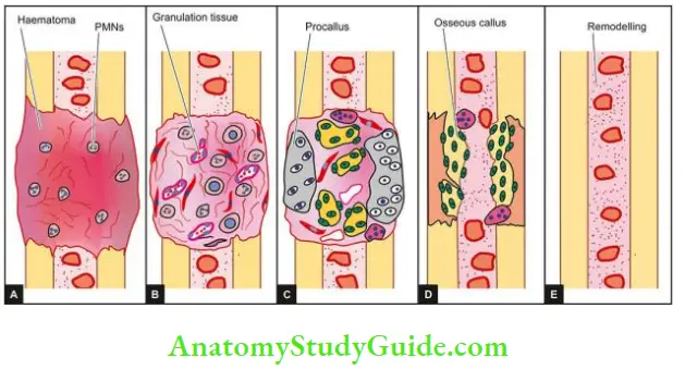 Tissue Repair And Regeneration Notes - Anatomy Study Guide