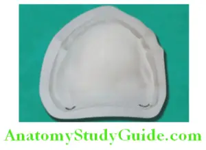 Anatomical Landmarks Edentulous Maxillary Arch Notes - Anatomy Study Guide
