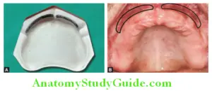 Anatomical Landmarks Edentulous Maxillary Arch Notes - Anatomy Study Guide