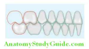 Complete Denture – Selection & Arrangement of Artificial Teeth ...