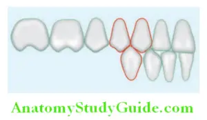 Complete Denture – Selection & Arrangement of Artificial Teeth ...