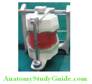 Complete Denture – Selection & Arrangement of Artificial Teeth ...