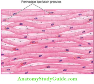 Pigments Endogenous And Exogenous Pathology Notes - Anatomy Study Guide