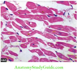 Pigments Endogenous And Exogenous Pathology Notes - Anatomy Study Guide
