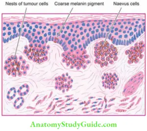 Pigments Endogenous And Exogenous Pathology Notes - Anatomy Study Guide