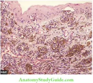 Pigments Endogenous And Exogenous Pathology Notes - Anatomy Study Guide