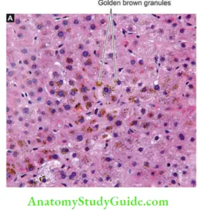 Pigments Endogenous And Exogenous Pathology Notes - Anatomy Study Guide