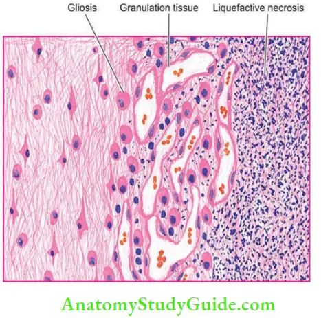 Cell Death Pathways In Irreversible Injury - Anatomy Study Guide