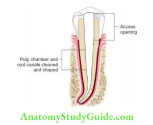 Cleaning And Shaping Of Root Canal System Notes - Anatomy Study Guide