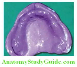 Complete Denture Impression Notes - Anatomy Study Guide
