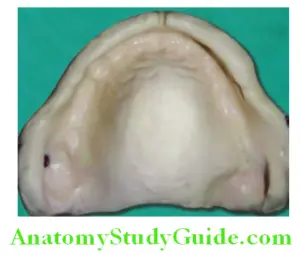 Complete Denture Impression Notes - Anatomy Study Guide