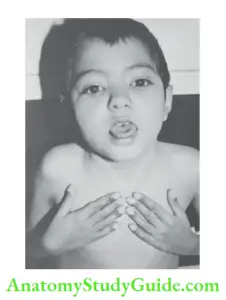 Differential Diagnosis Of Common Abnormal Physical Signs Notes ...