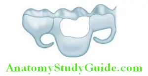Direct And Indirect Retainers in Preclinical Prosthodontics - Anatomy ...