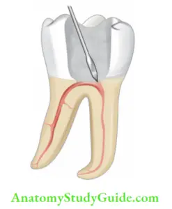 Endodontic Instruments Classification Notes - Anatomy Study Guide