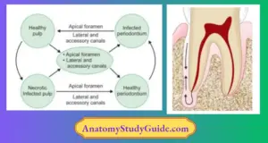 Endodontic Periodontal Lesions - Anatomy Study Guide