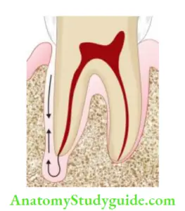 Endodontic Periodontal Lesions - Anatomy Study Guide