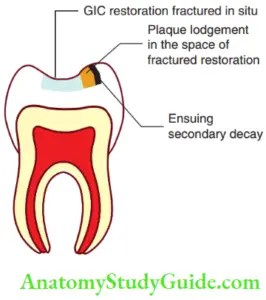Essentials Of Dental Caries Notes - Anatomy Study Guide