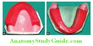 Fabrication Of Occlusal Rims Notes - Anatomy Study Guide