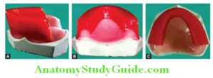 Fabrication Of Occlusal Rims Notes - Anatomy Study Guide