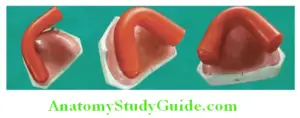 Fabrication Of Occlusal Rims Notes - Anatomy Study Guide