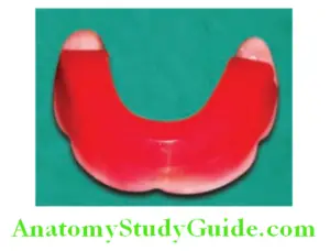 Fabrication Of Occlusal Rims Notes - Anatomy Study Guide
