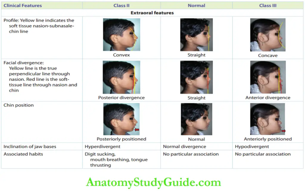 Interceptive Orthodontics in Pediatric Dentistry Notes - Anatomy Study ...