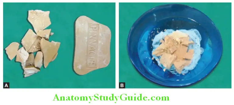 Making Primary Impression of Maxillary and Mandibular Edentulous ...