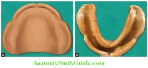 Making Primary Impression of Maxillary and Mandibular Edentulous ...