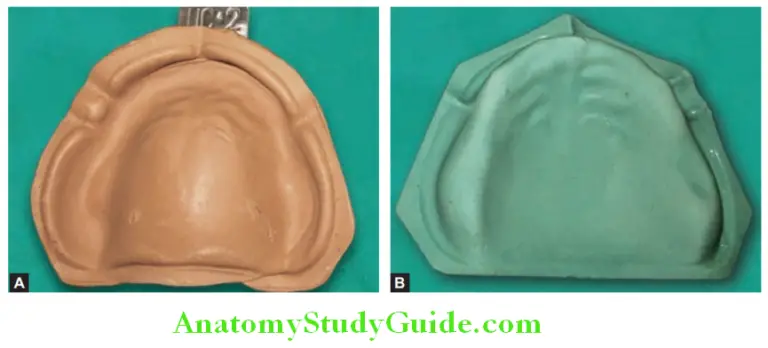 Making Primary Impression of Maxillary and Mandibular Edentulous ...