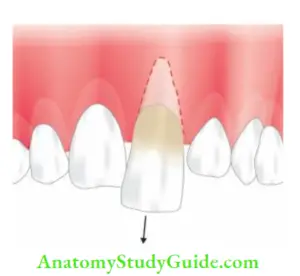 Luxation Injuries Treatment Notes - Anatomy Study Guide