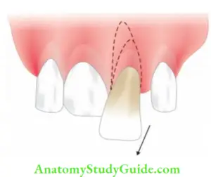 Luxation Injuries Treatment Notes - Anatomy Study Guide