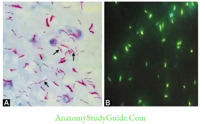 Mycobacteria Notes - Anatomy Study Guide
