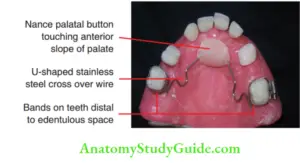 Preventive Orthodontics Notes - Anatomy Study Guide