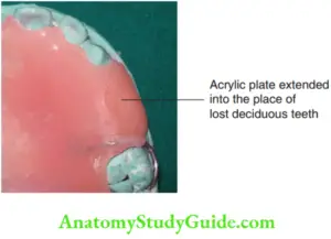 Preventive Orthodontics Notes - Anatomy Study Guide