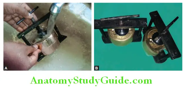 Complete Denture – Flasking, Dewaxing & Packing Notes - Anatomy Study Guide