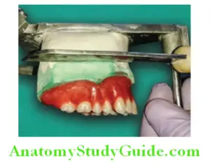 Complete Denture – Flasking, Dewaxing & Packing Notes - Anatomy Study Guide