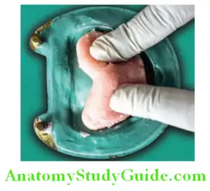 Complete Denture – Flasking, Dewaxing & Packing Notes - Anatomy Study Guide