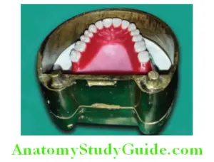 Complete Denture – Flasking, Dewaxing & Packing Notes - Anatomy Study Guide