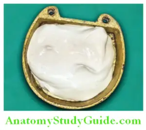Complete Denture – Flasking, Dewaxing & Packing Notes - Anatomy Study Guide