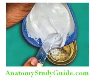 Complete Denture – Flasking, Dewaxing & Packing Notes - Anatomy Study Guide