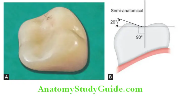 Implant Prosthesis Procedure Notes - Anatomy Study Guide