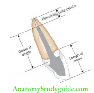 Restoration Of Endodontically Treated Teeth - Anatomy Study Guide