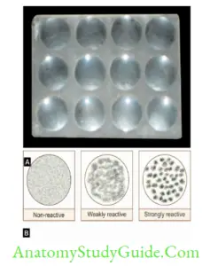 Spirochetes Notes - Anatomy Study Guide
