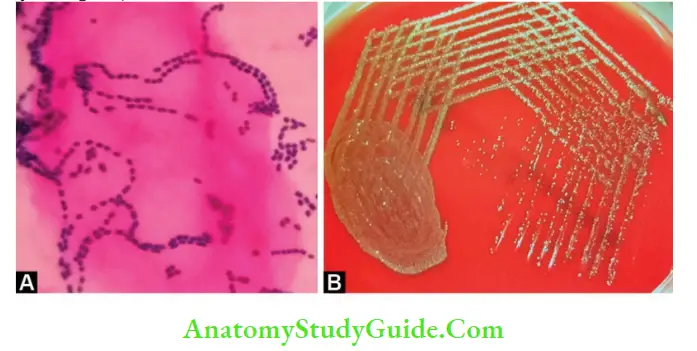 Streptococcus Pneumocococcus Notes - Anatomy Study Guide