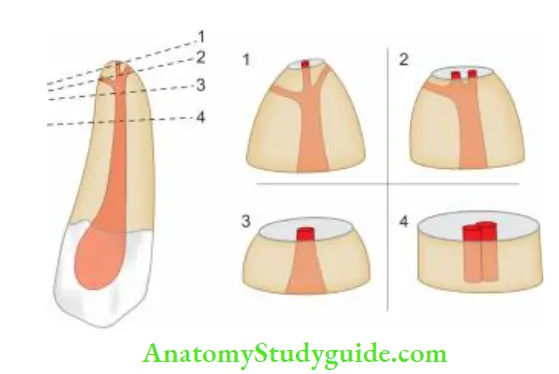 Principles Of Surgical Access To Root Structure Notes - Anatomy Study Guide