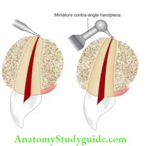 Principles Of Surgical Access To Root Structure Notes - Anatomy Study Guide
